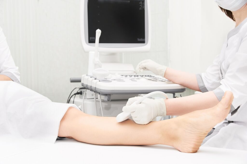 Benefits of Minimally Invasive Vein Treatment - Dayton, OH Benefits of Minimally Invasive Vein Treatment - Dayton, OH